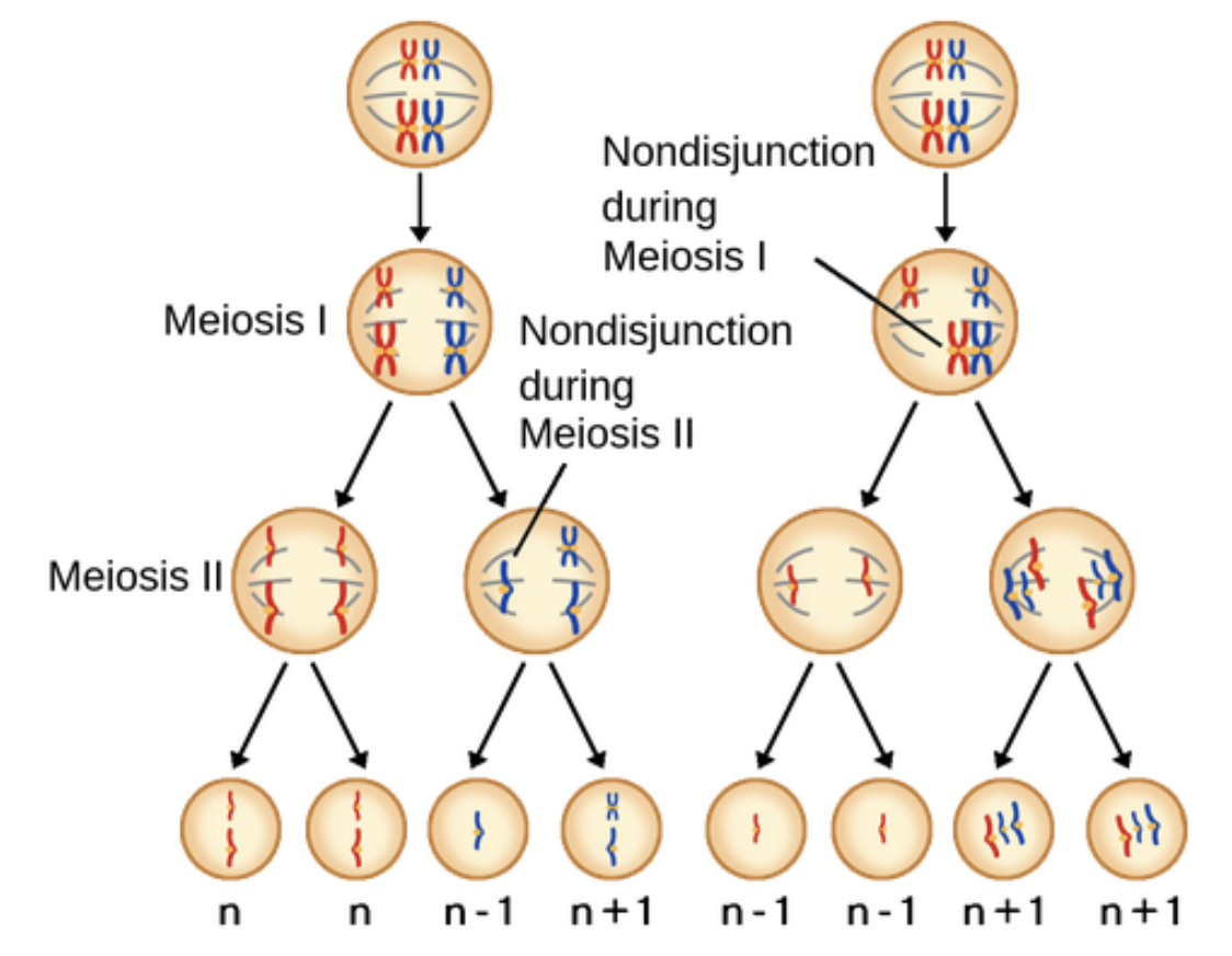 Hội chứng Edwards trong thai kì - Phòng khám Sản- Phụ khoa - Hiếm muộn ...
